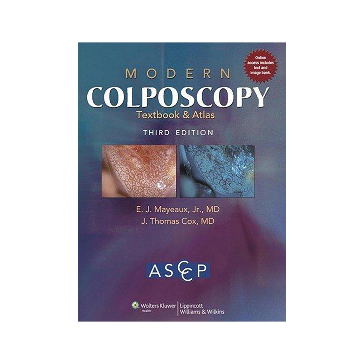 Modern Colposcopy Textbook and Atlas | literatura.mk